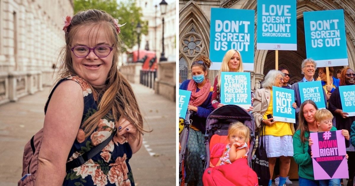 On World Down Syndrome Day, fight ableism, don’t pretend it doesn’t ...